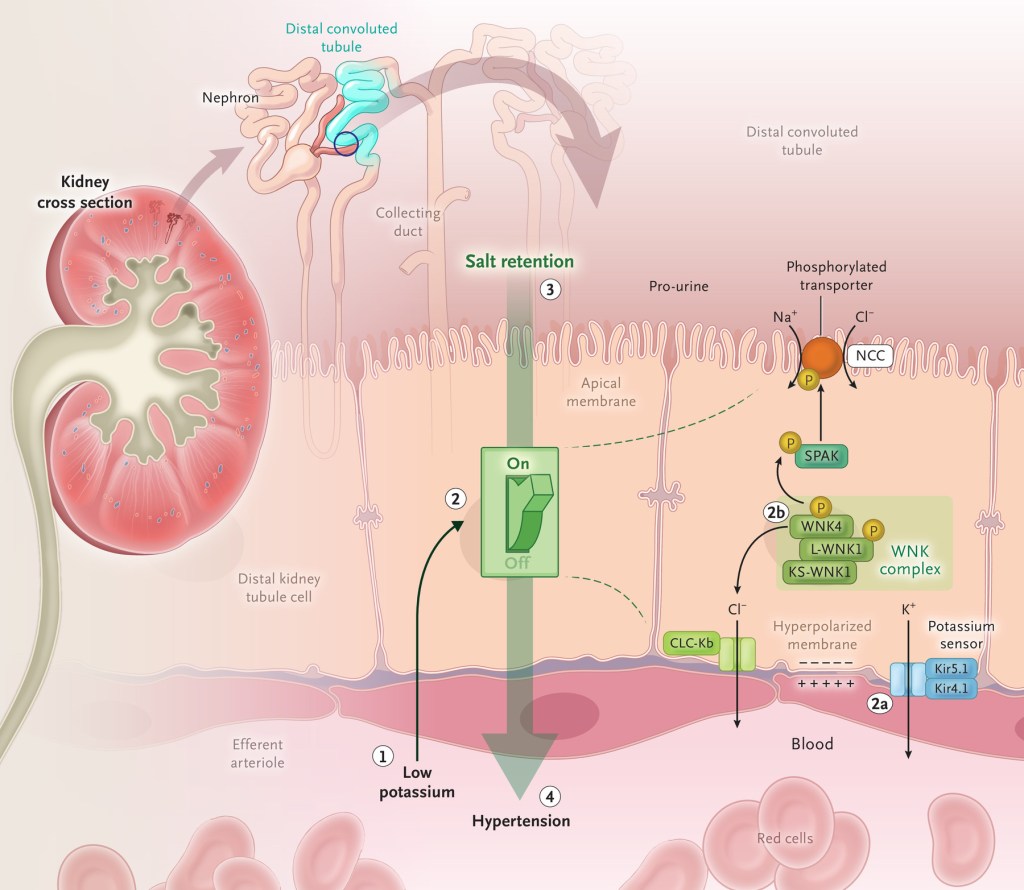 Gitelman Syndrome – Kidney Physiology